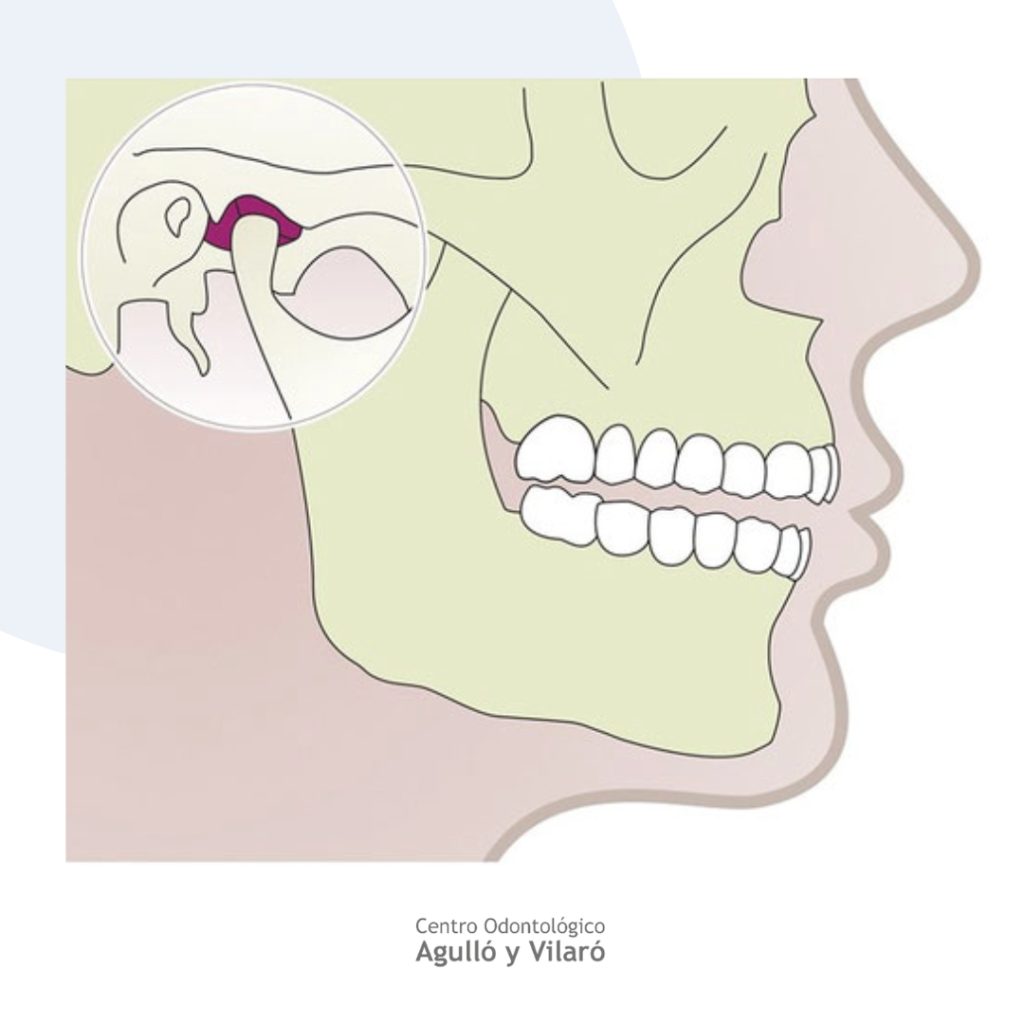 ¿Qué es el eje de rotación mandibular? - Clínica Odontológica Agulló y ...